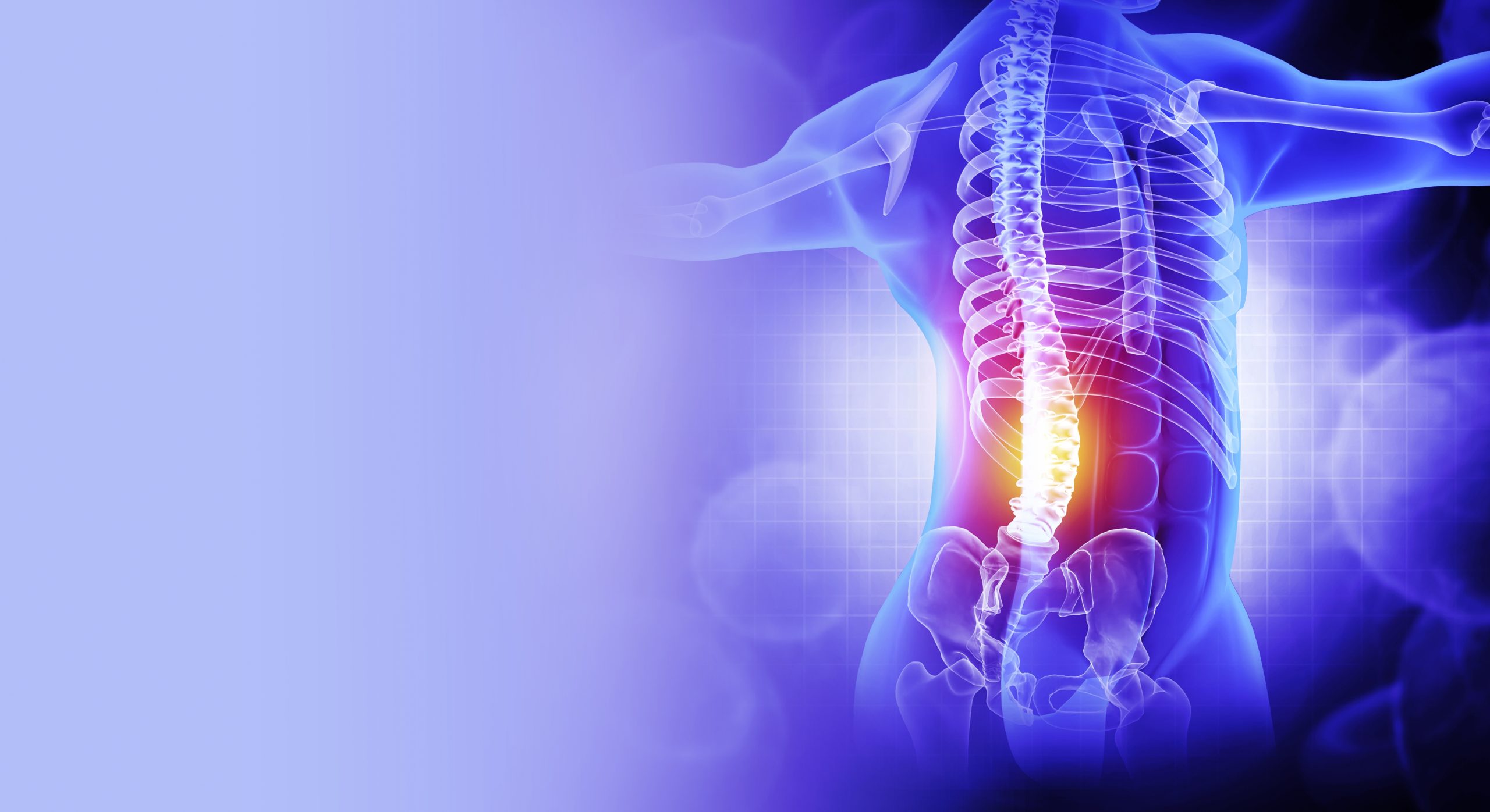 “Failed Back Surgery Syndrome: Turning setbacks into comebacks.” - Pain ...