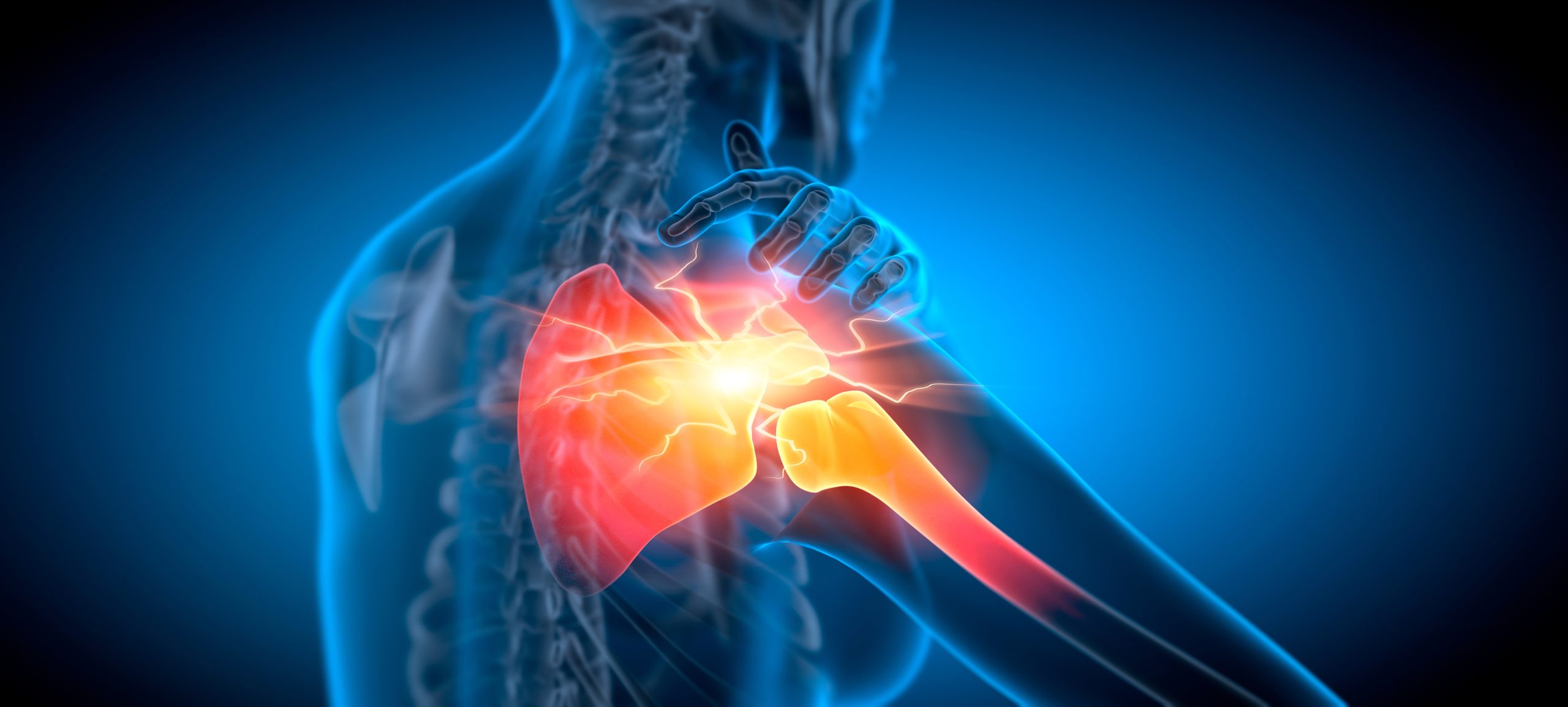 “From strain to strength—shoulder pain has a path to relief.” - Pain ...