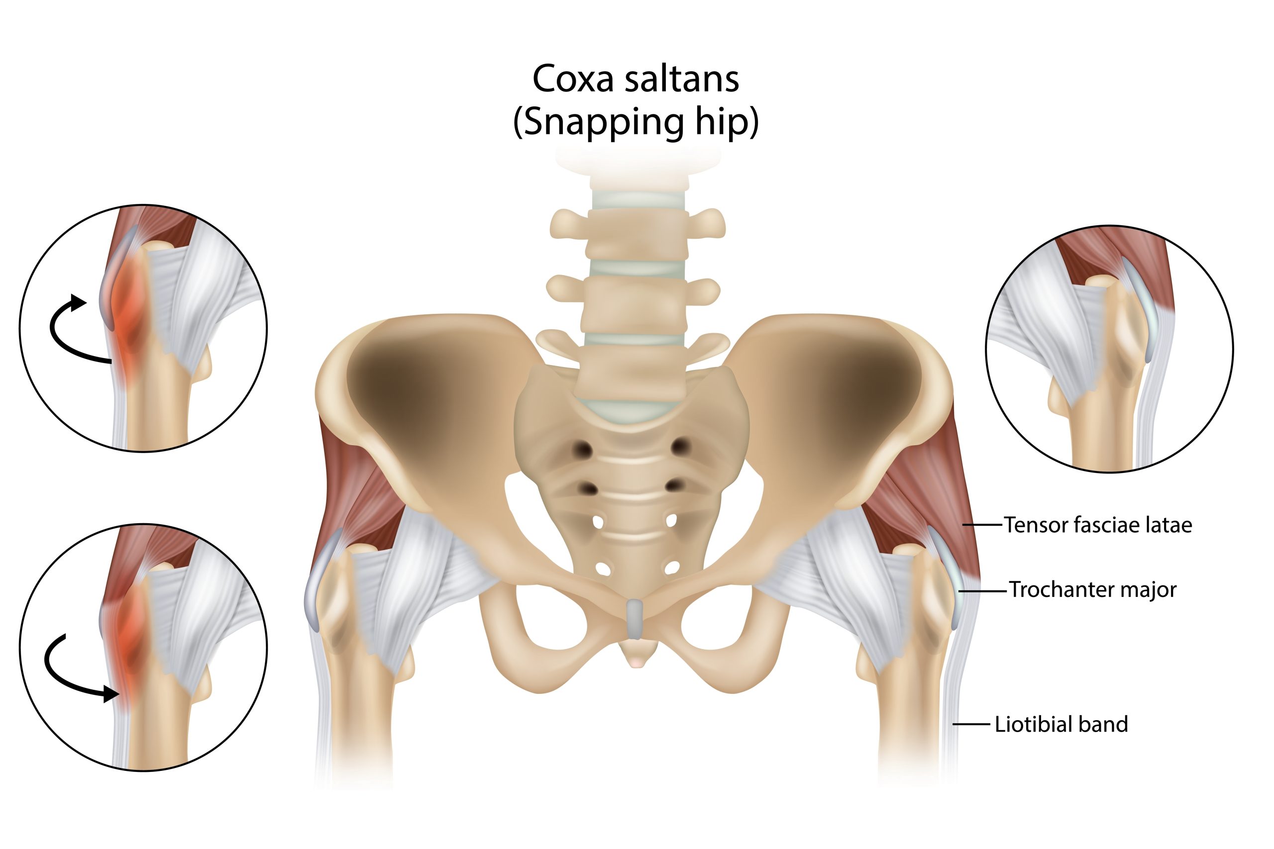 “Know the snap, manage the movement.” - Pain Institute of Southern Arizona